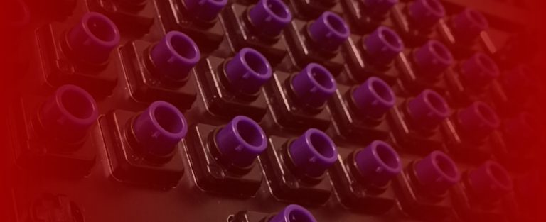 Topre Switches: Hybrid Design with Premium Feel (and Price)